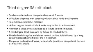 COMPLETE ATRIOVENTRICULAR HEART BLOCK.pptx