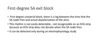 COMPLETE ATRIOVENTRICULAR HEART BLOCK.pptx