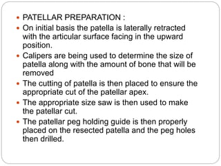 Complete Knee Replacement Treatment | PPT