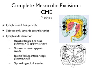 Complete mesocolic excision | PPT