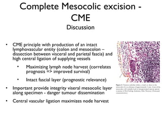 Complete mesocolic excision | PPT