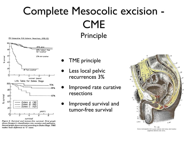 Complete mesocolic excision | PPT | Medical Health
