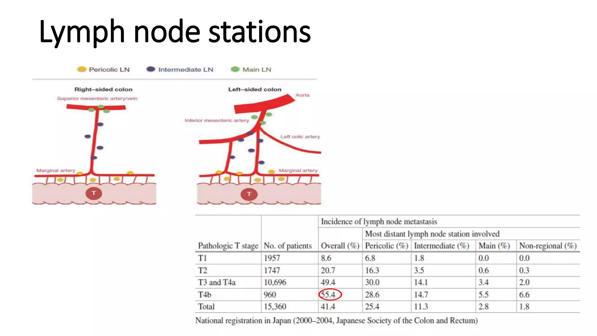 Complete mesocolic excision (CME) Vs D2.pptx