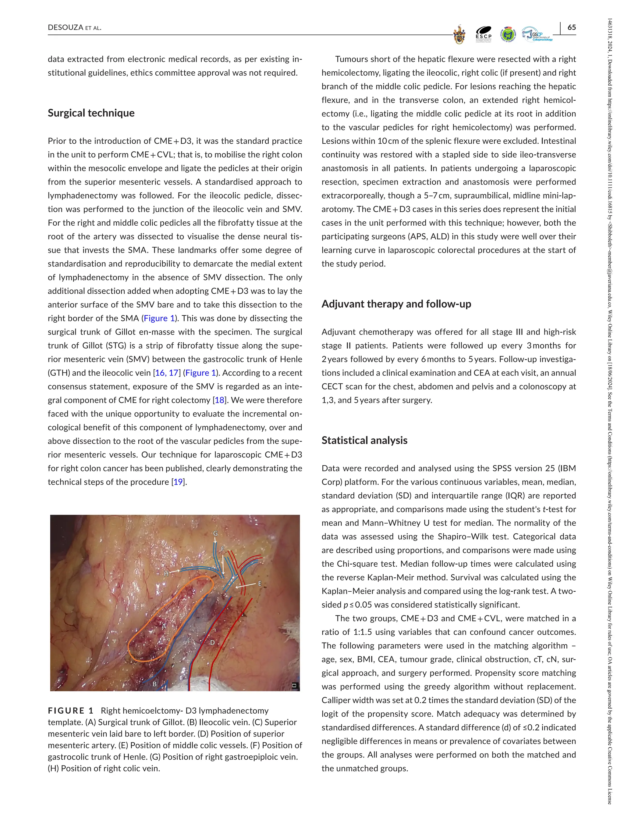 Complete mesocolic excision for right colon cancer_ Is D3 ...