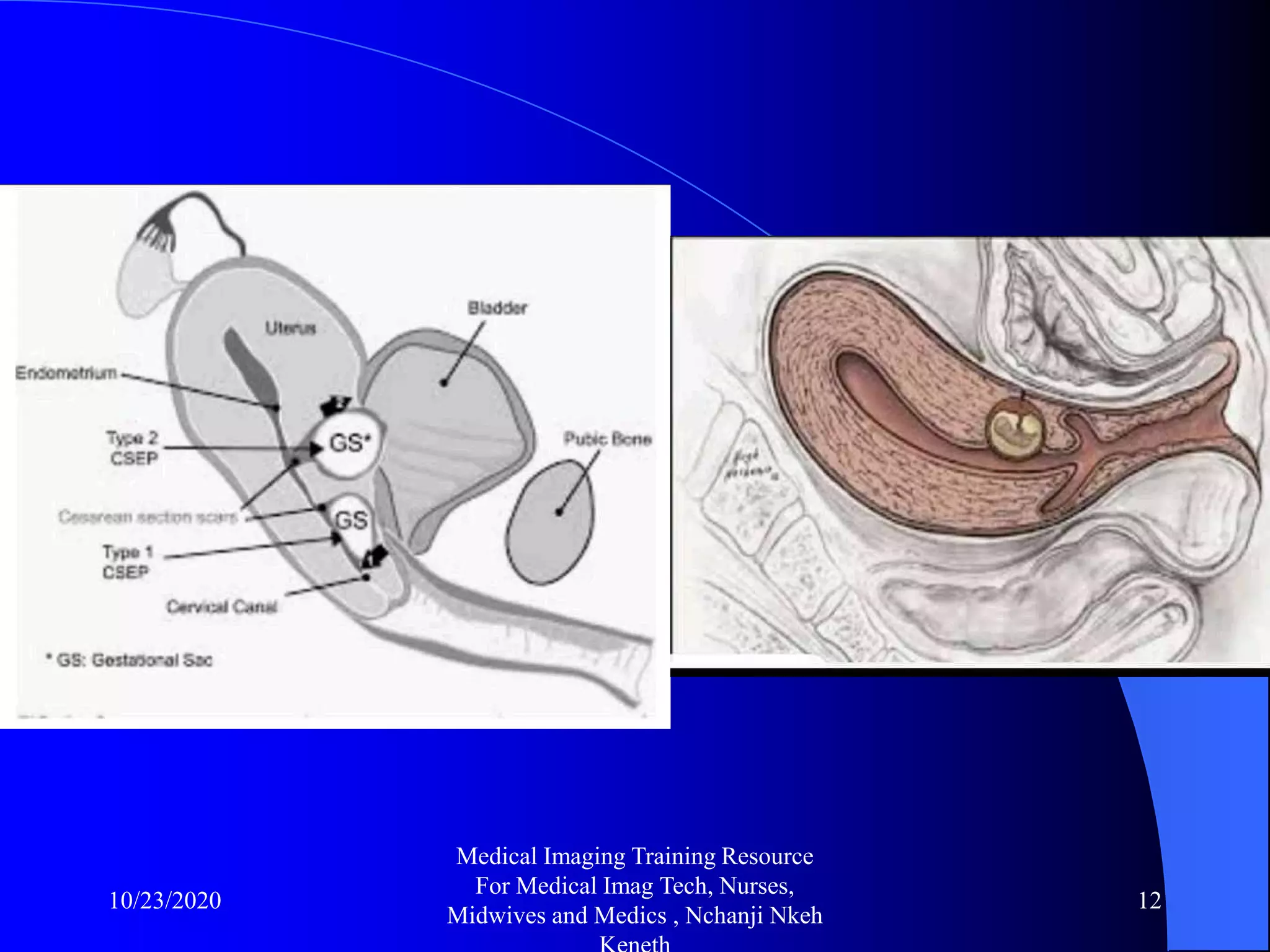 Complete obstetrics ultrasound radiology training nchanji nkeh keneth | PPT