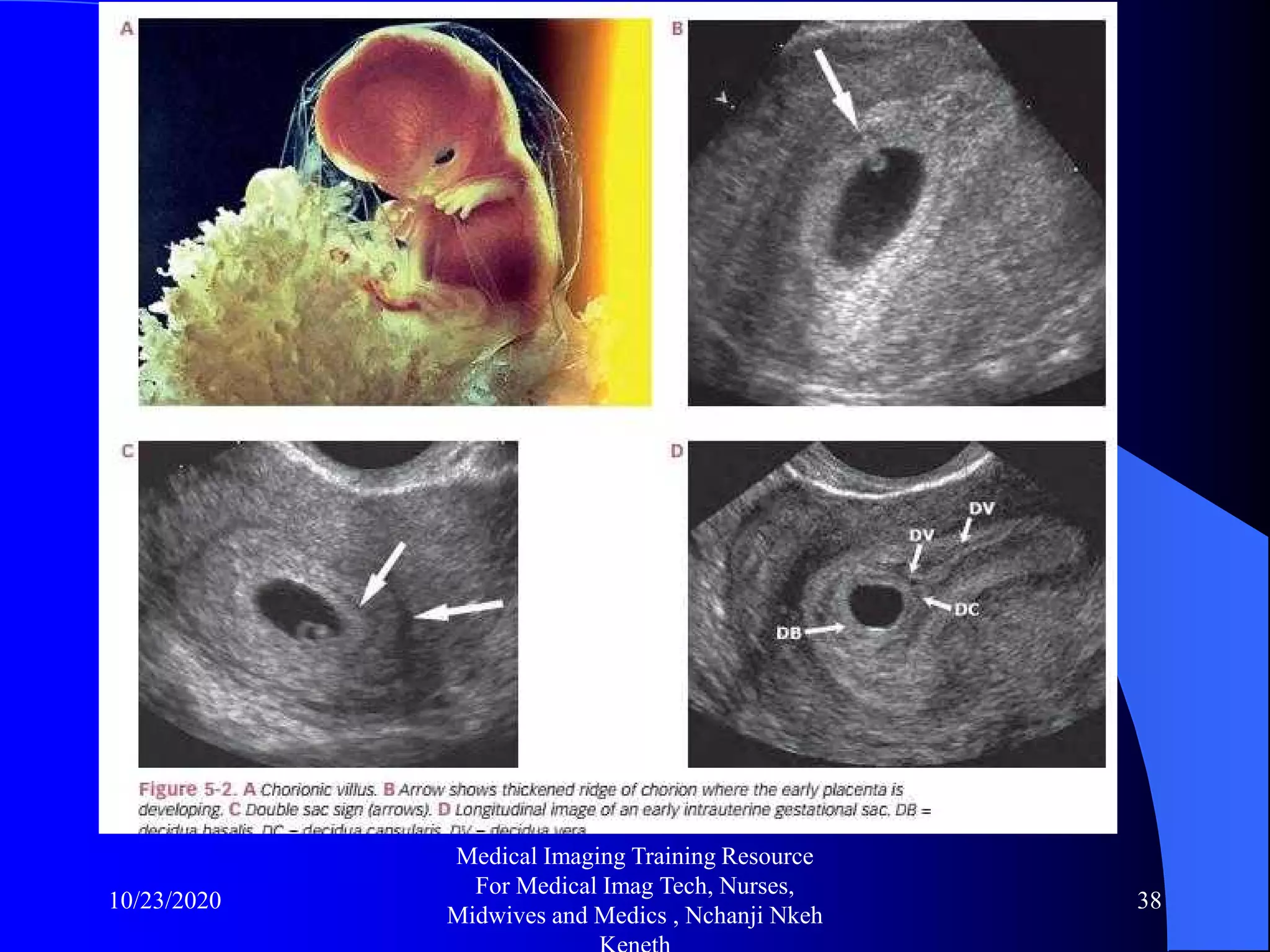 Complete obstetrics ultrasound radiology training nchanji nkeh keneth | PDF