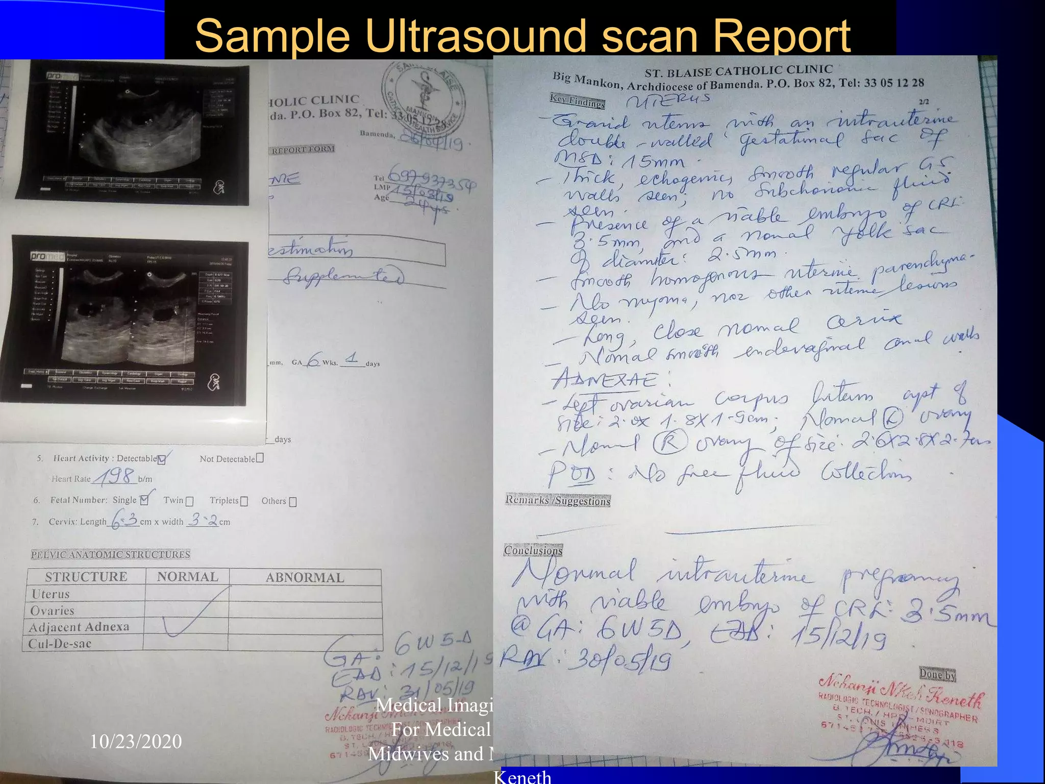 Complete obstetrics ultrasound radiology training nchanji nkeh keneth | PDF