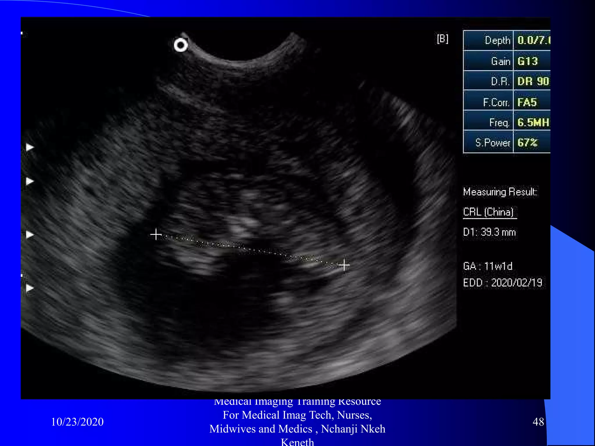 Complete obstetrics ultrasound radiology training nchanji nkeh keneth | PPT