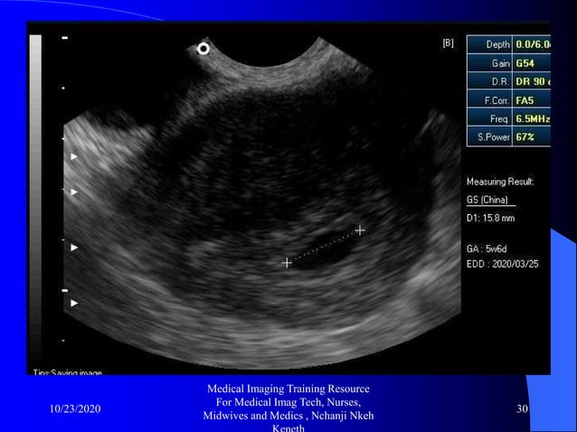 Complete obstetrics ultrasound radiology training nchanji nkeh keneth | PPT