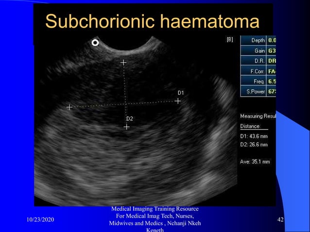 Complete obstetrics ultrasound radiology training nchanji nkeh keneth | PPT
