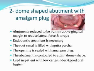 Complete overdenture(3) | PDF