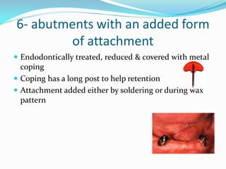 Complete overdenture(3) | PDF