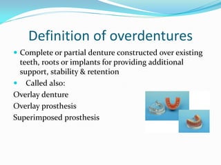 Complete overdenture(3) | PDF