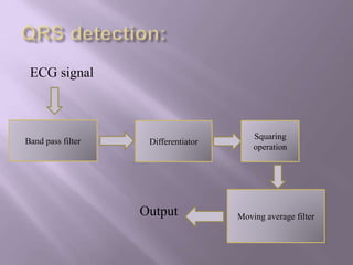 Complete pan tompkins implementation of ecg qrs detector | PPTX