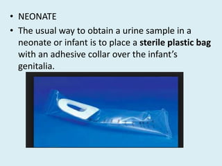Complete urine examination | PPTX