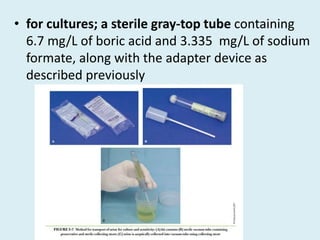 Complete urine examination | PPTX
