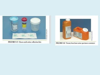 Complete urine examination | PPTX