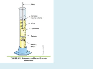 Complete urine examination | PPTX