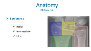 Complex Distal Radius Fracture #dr_azanki | PPTX