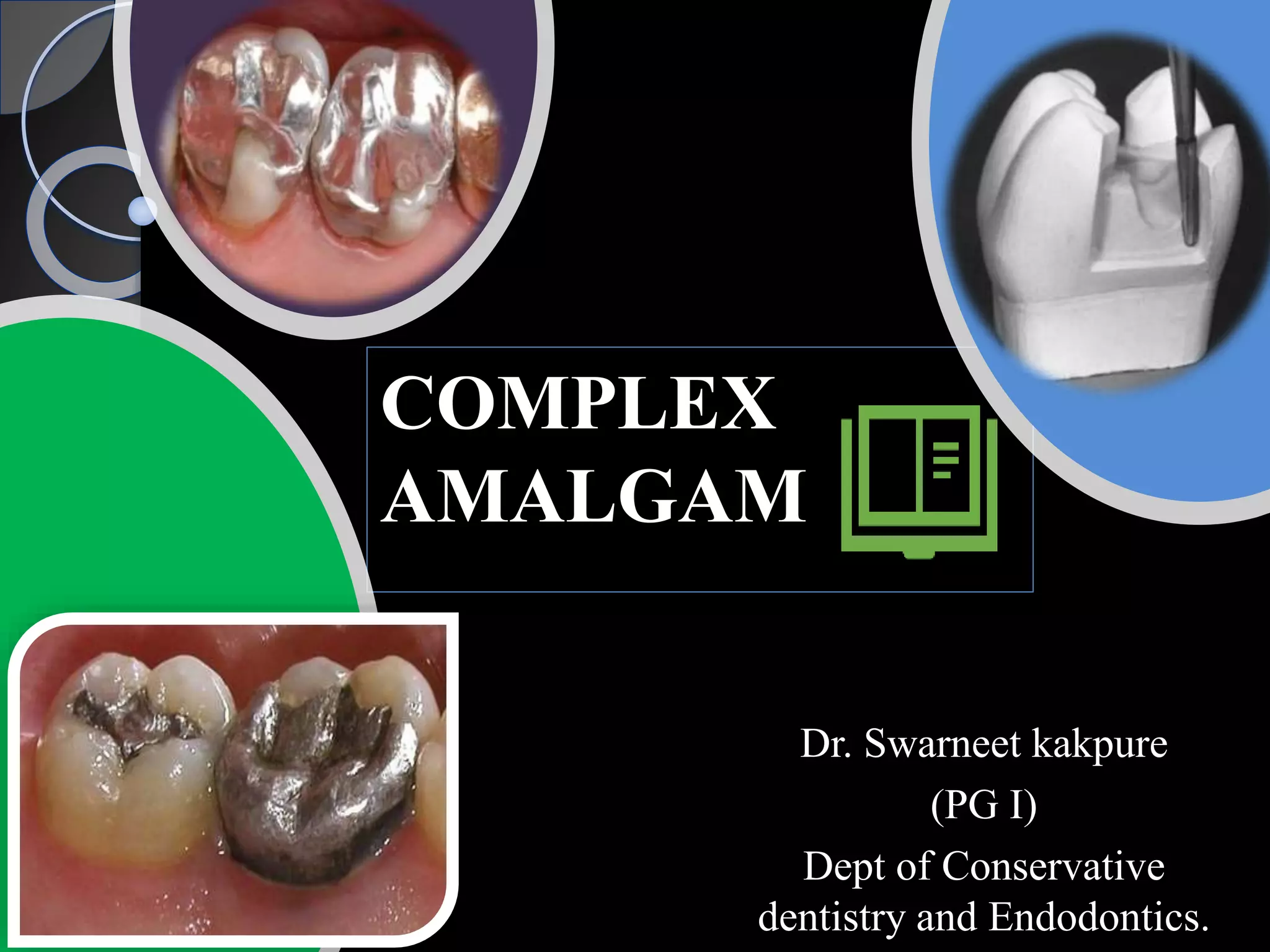 Complex amalgam restorations | PPTX