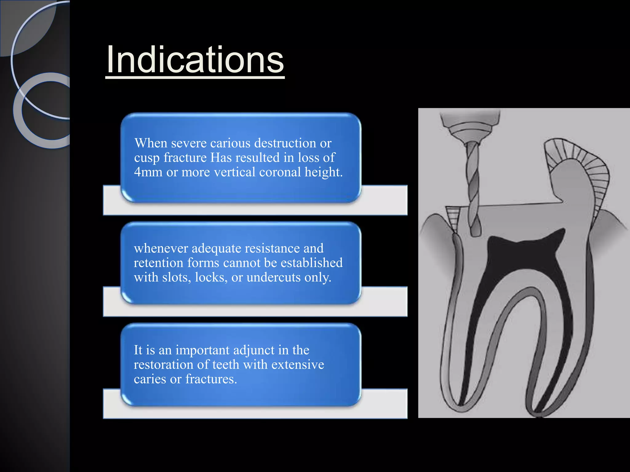 Complex amalgam restorations | PPTX