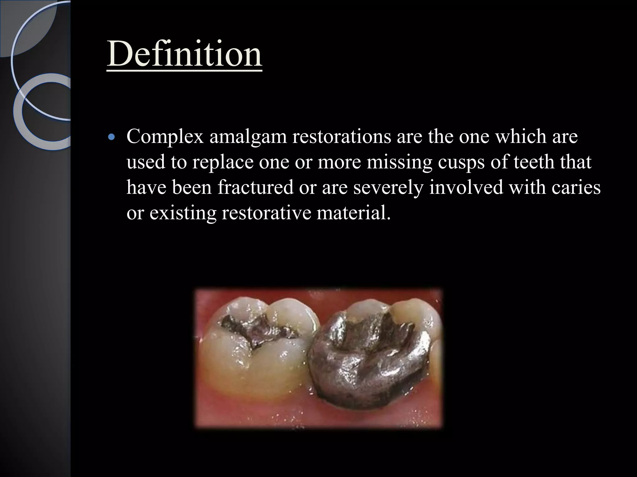 Complex amalgam restorations | PPTX