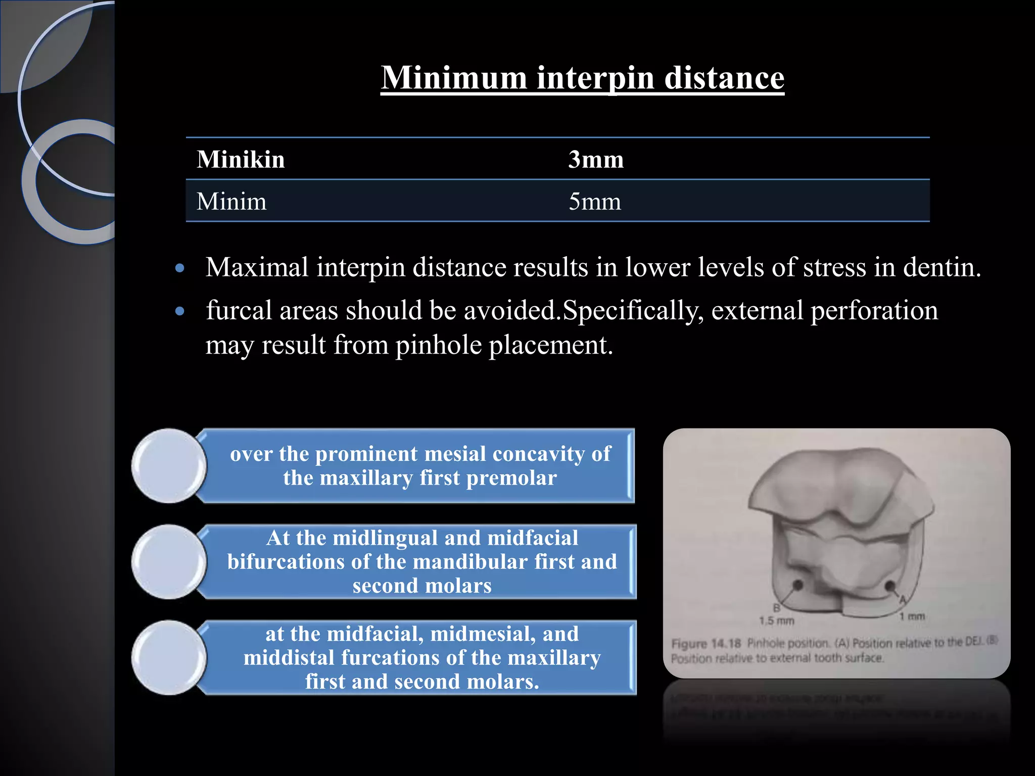 Complex amalgam restorations | PPTX