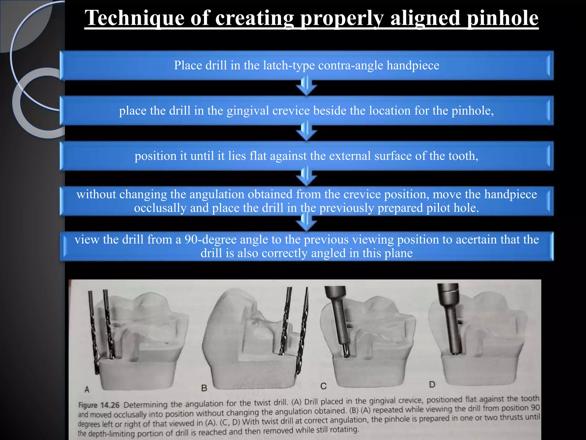Complex amalgam restorations | PPTX