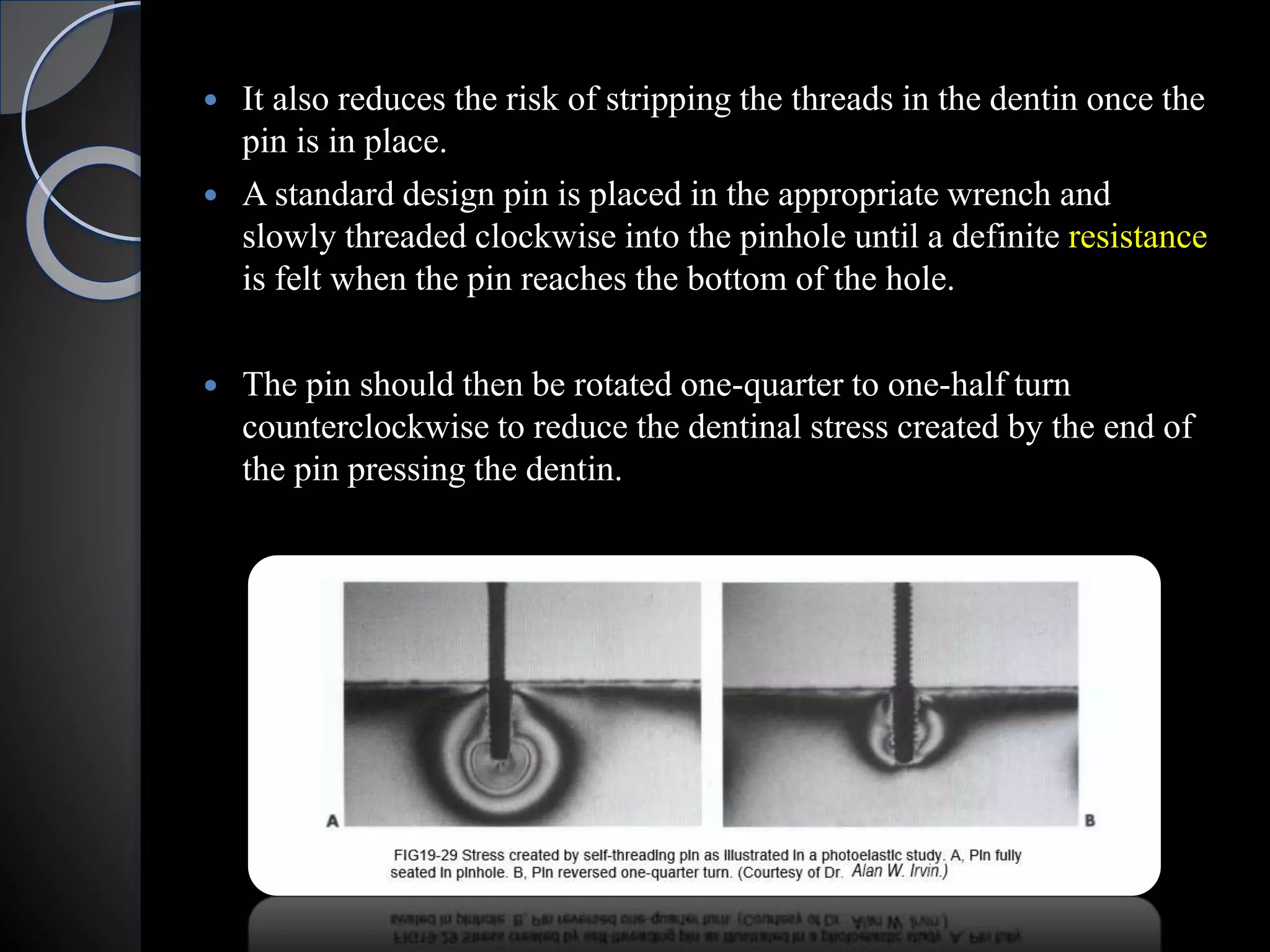 Complex amalgam restorations | PPTX