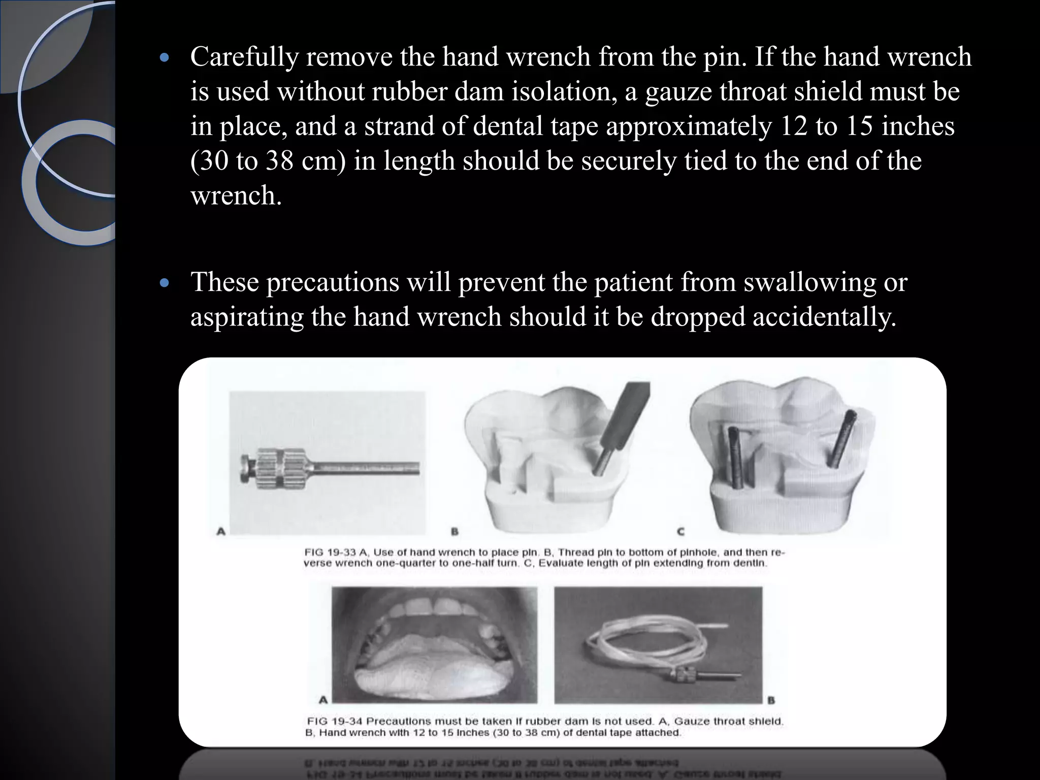 Complex amalgam restorations | PPTX