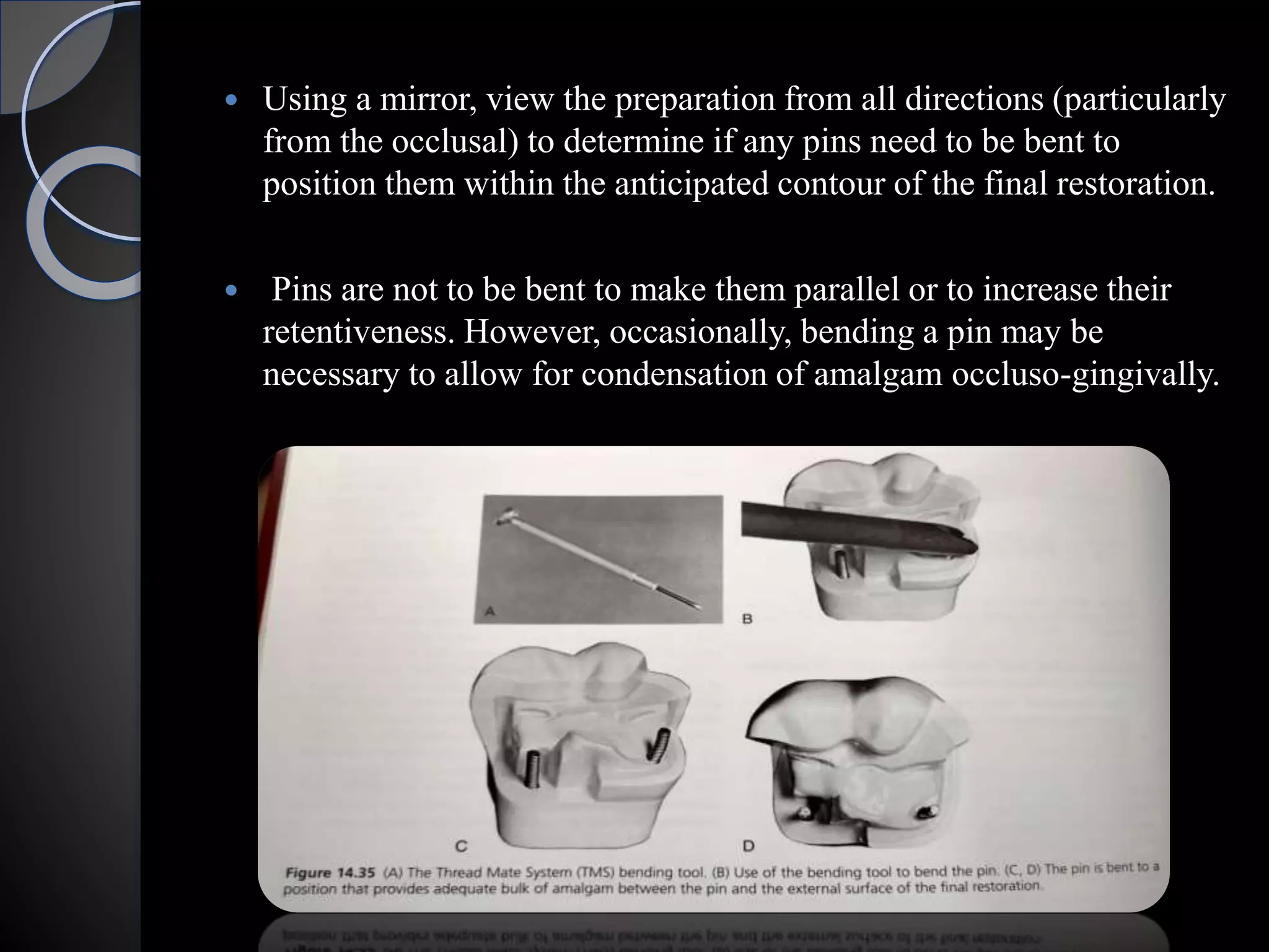 Complex amalgam restorations | PPTX