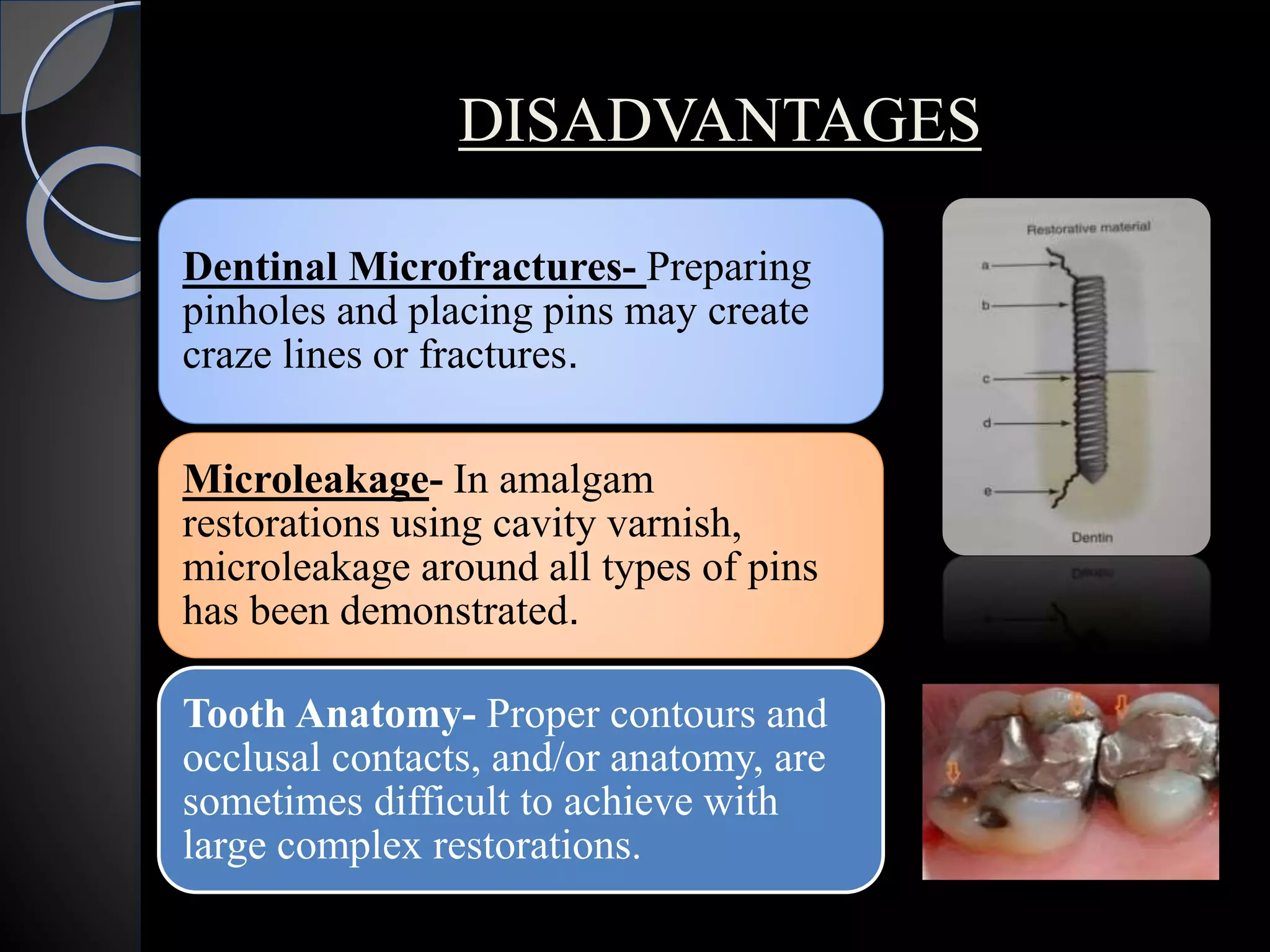 Complex amalgam restorations | PPTX