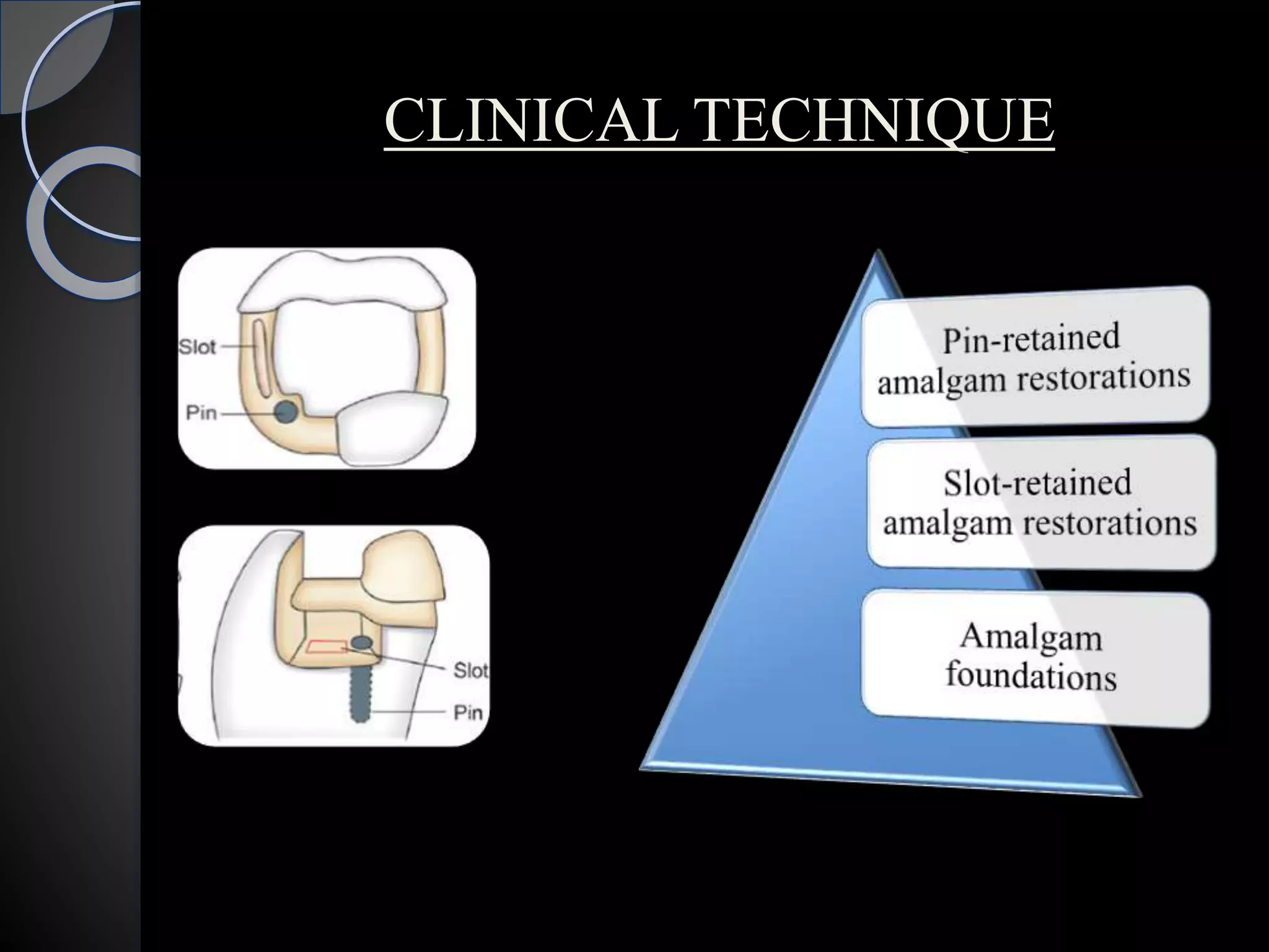 Complex amalgam restorations | PPTX