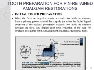 Complex amalgam restoration | PPTX
