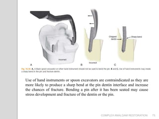 Complex amalgam restoration | PPTX