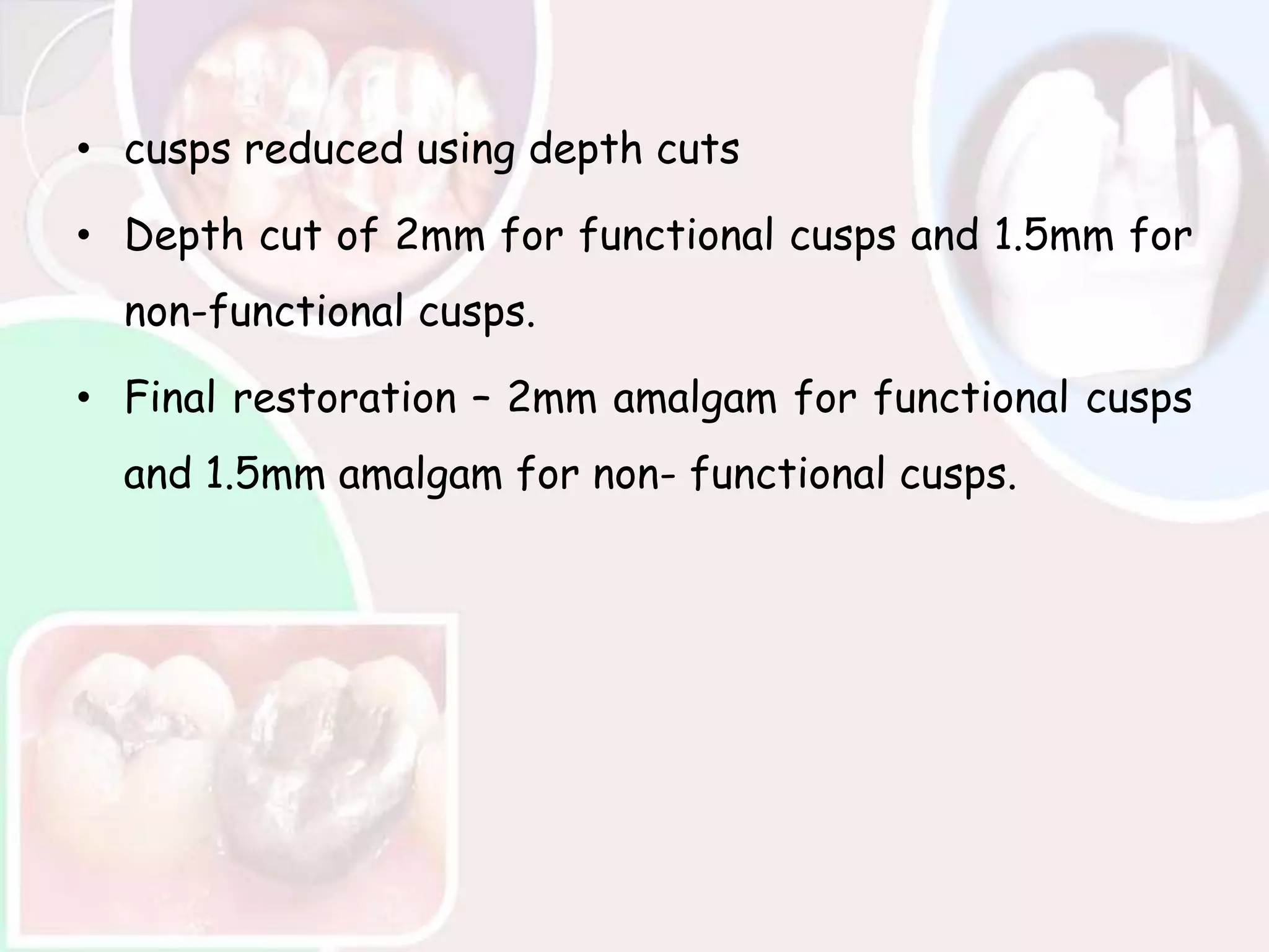 Complex amalgam restoration | PPTX