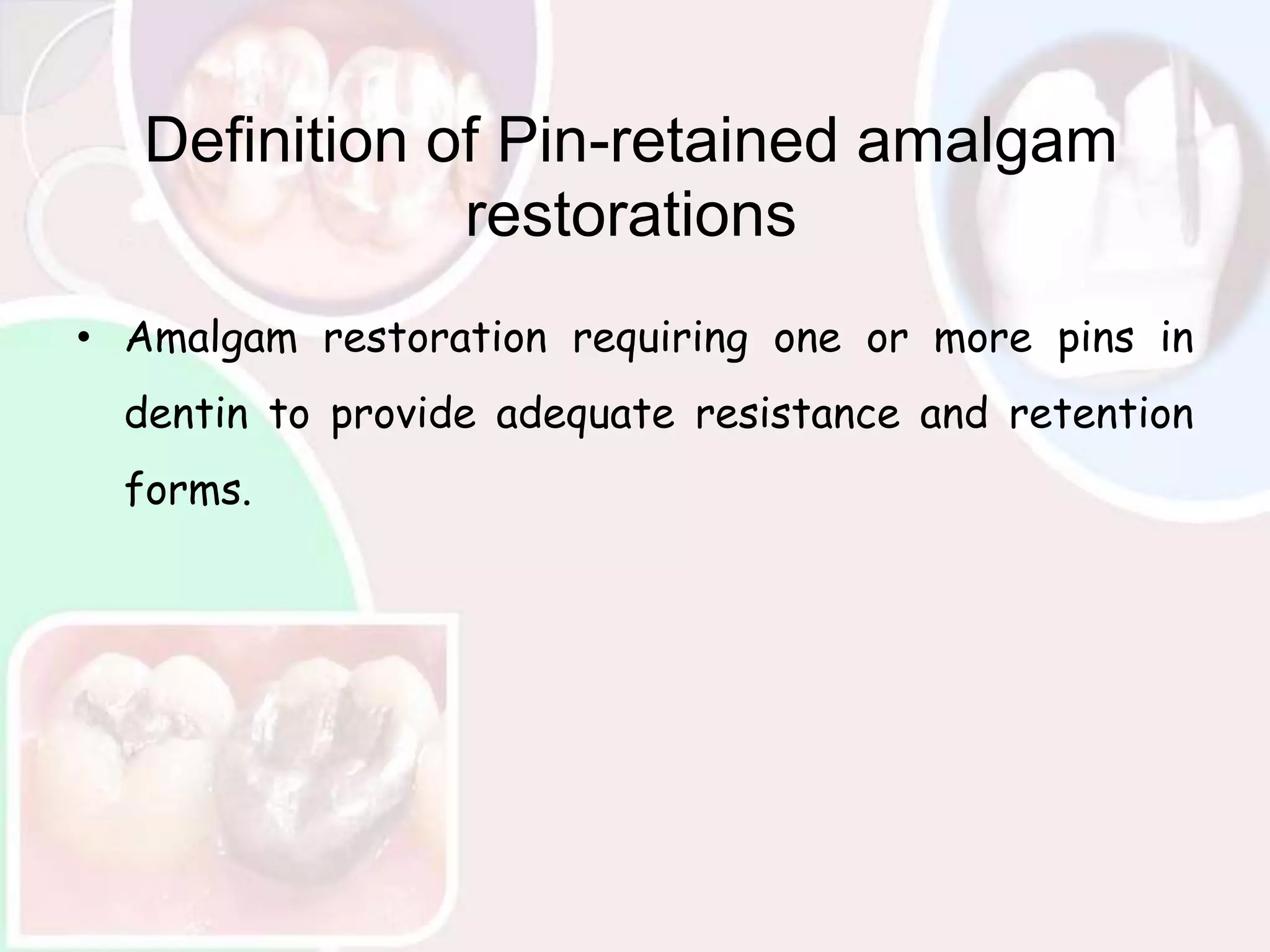 Complex amalgam restoration | PPTX | Dental Health | Diseases and Conditions
