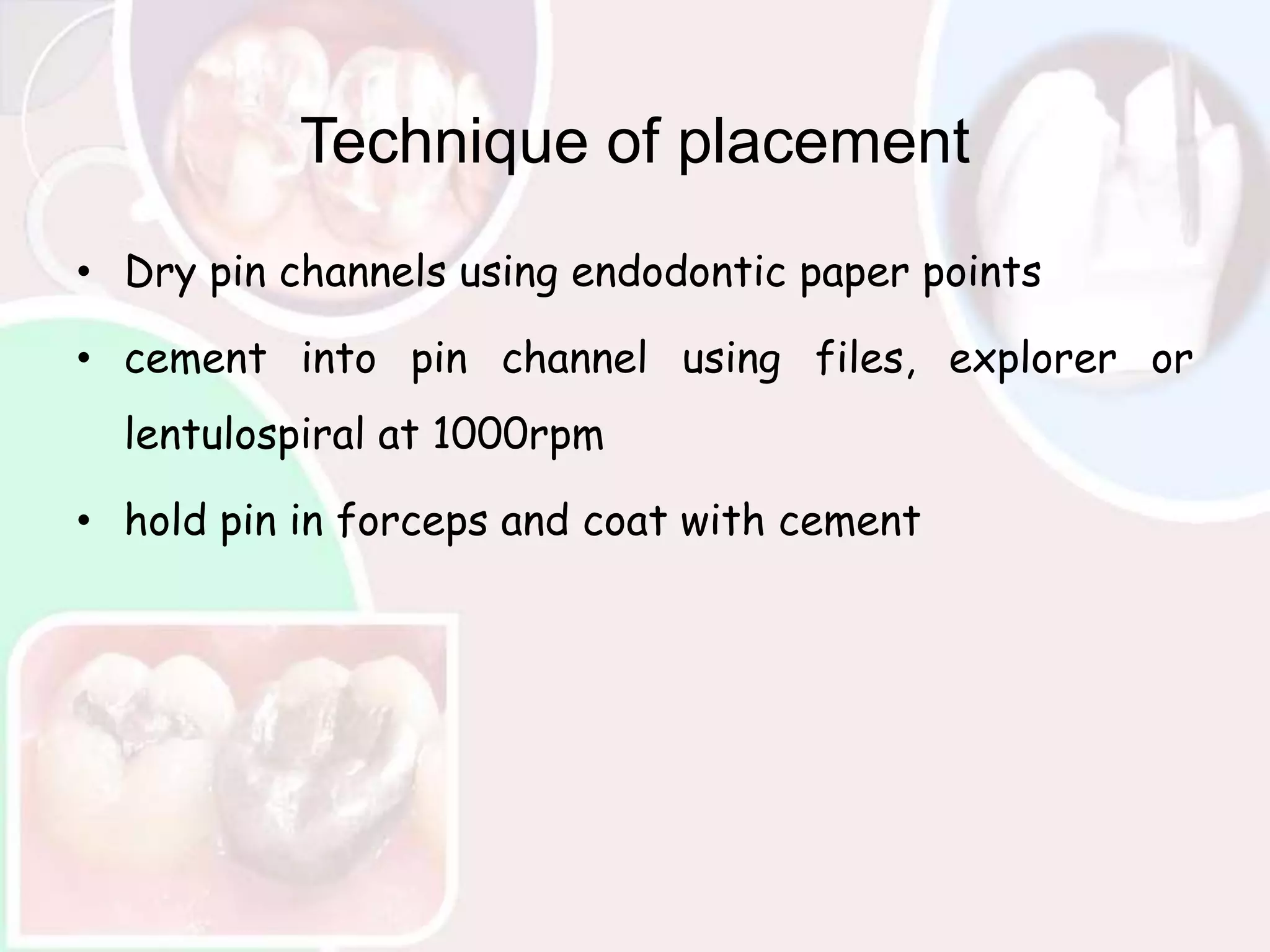 Complex amalgam restoration | PPTX