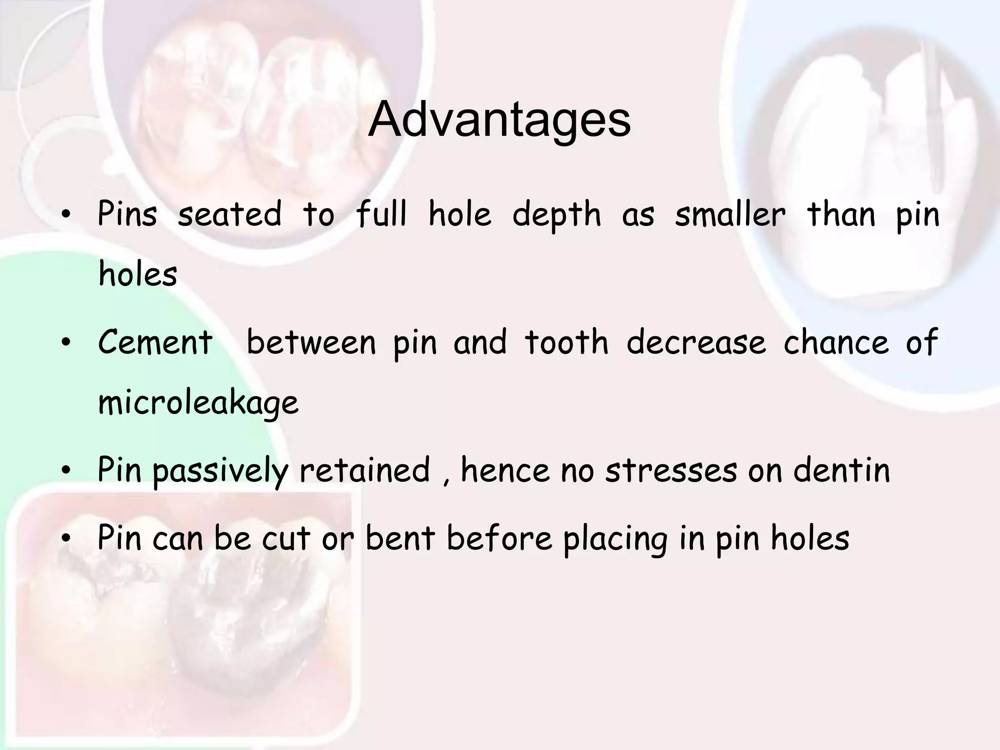 Complex amalgam restoration | PPTX