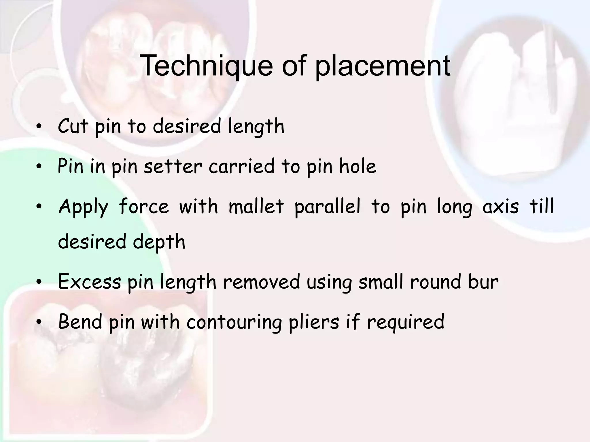 Complex amalgam restoration | PPTX