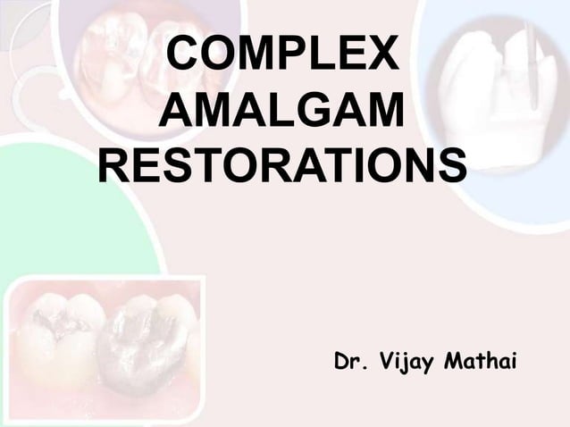 Complex amalgam restoration | PPTX | Dental Health | Diseases and ...