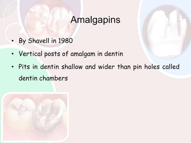 Complex amalgam restoration | PPTX | Dental Health | Diseases and Conditions