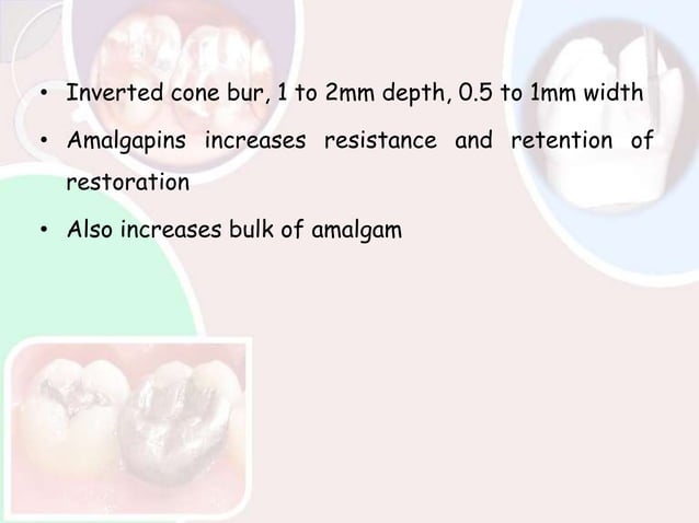 Complex amalgam restoration | PPTX | Dental Health | Diseases and ...