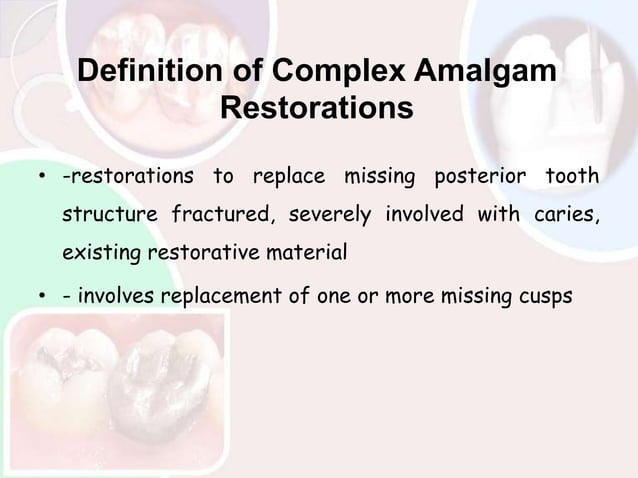 Complex amalgam restoration | PPTX | Dental Health | Diseases and ...