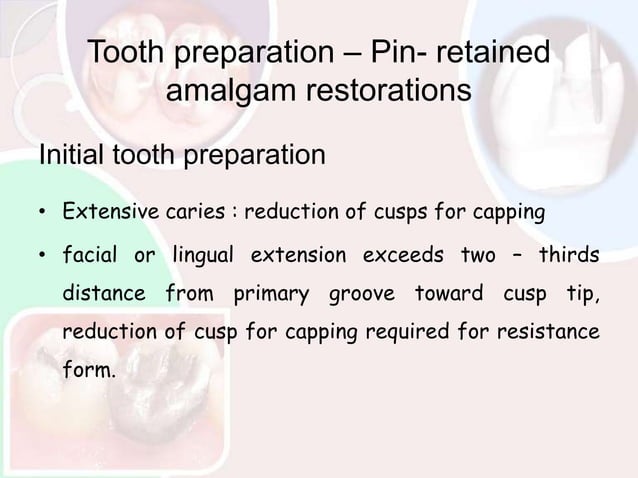 Complex amalgam restoration | PPTX | Dental Health | Diseases and ...