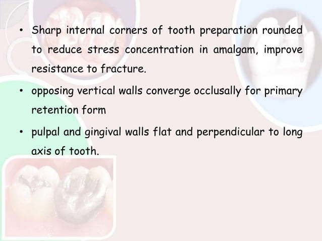 Complex amalgam restoration | PPTX | Dental Health | Diseases and ...