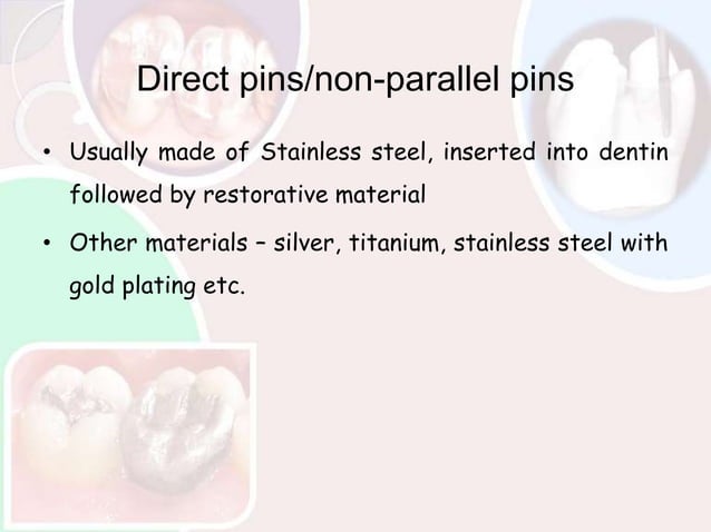Complex amalgam restoration | PPTX | Dental Health | Diseases and ...