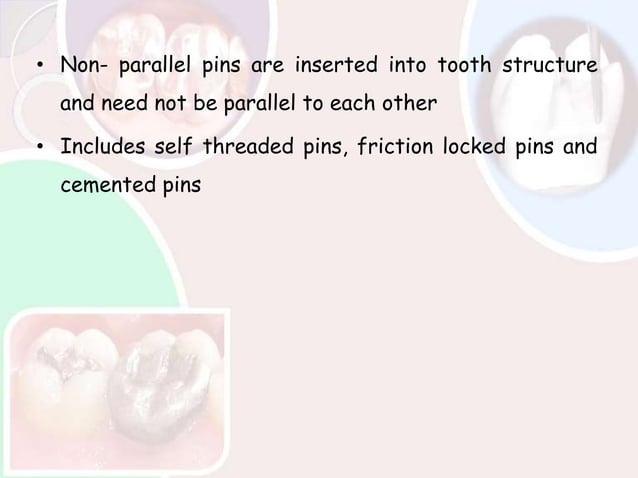 Complex amalgam restoration | PPTX | Dental Health | Diseases and ...