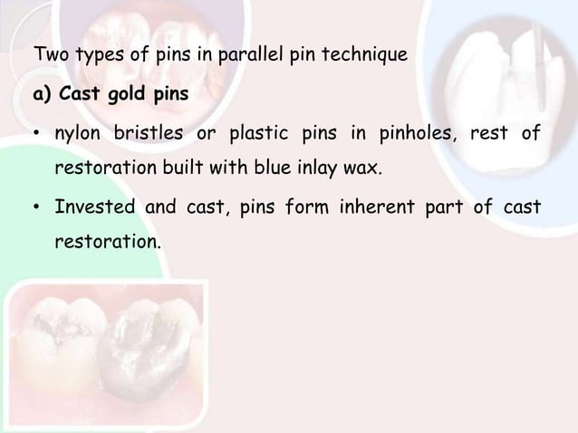 Complex amalgam restoration | PPTX | Dental Health | Diseases and ...