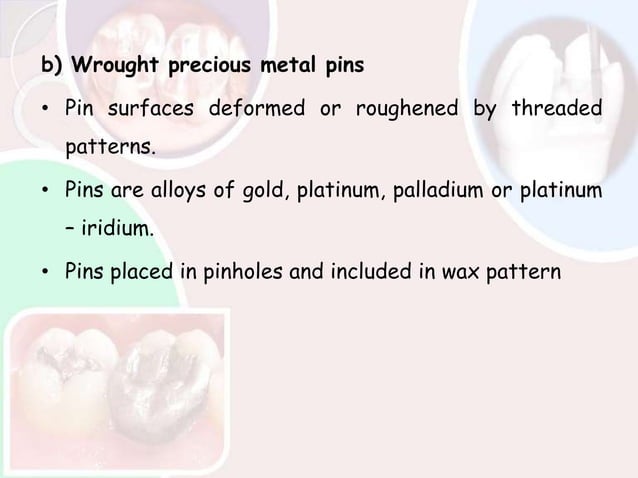 Complex amalgam restoration | PPTX | Dental Health | Diseases and ...